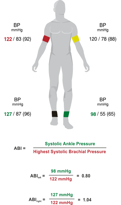Ankle Brachial Index ABI Medis GmbH